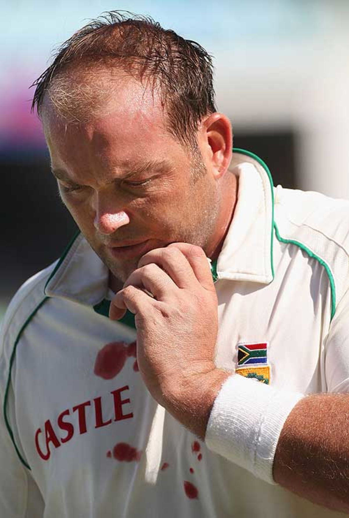 Jacques Kallis was forced to retire hurt | ESPNcricinfo.com