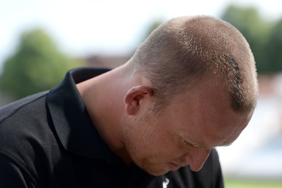 Luke Fletcher shows the after-effects of his blow on the head ...