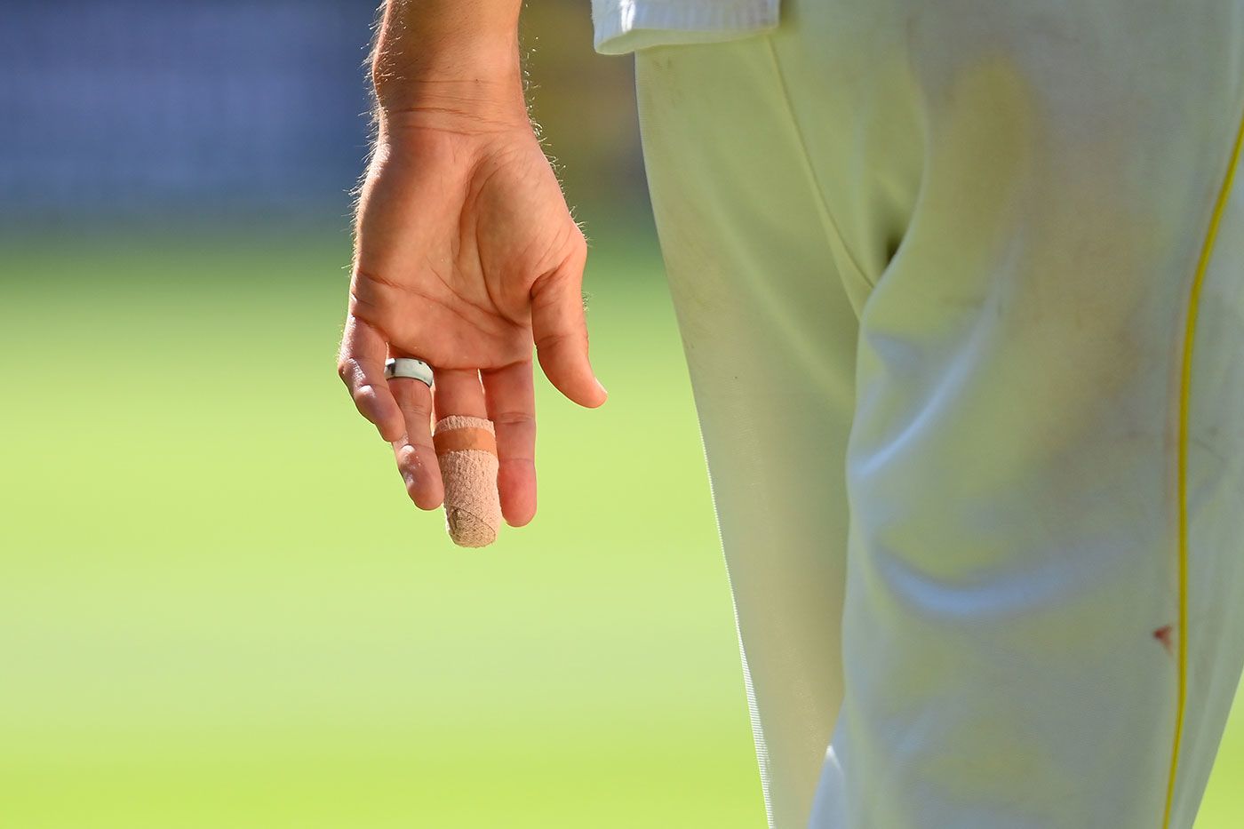 Mitchell Starc with his finger taped up | ESPNcricinfo.com