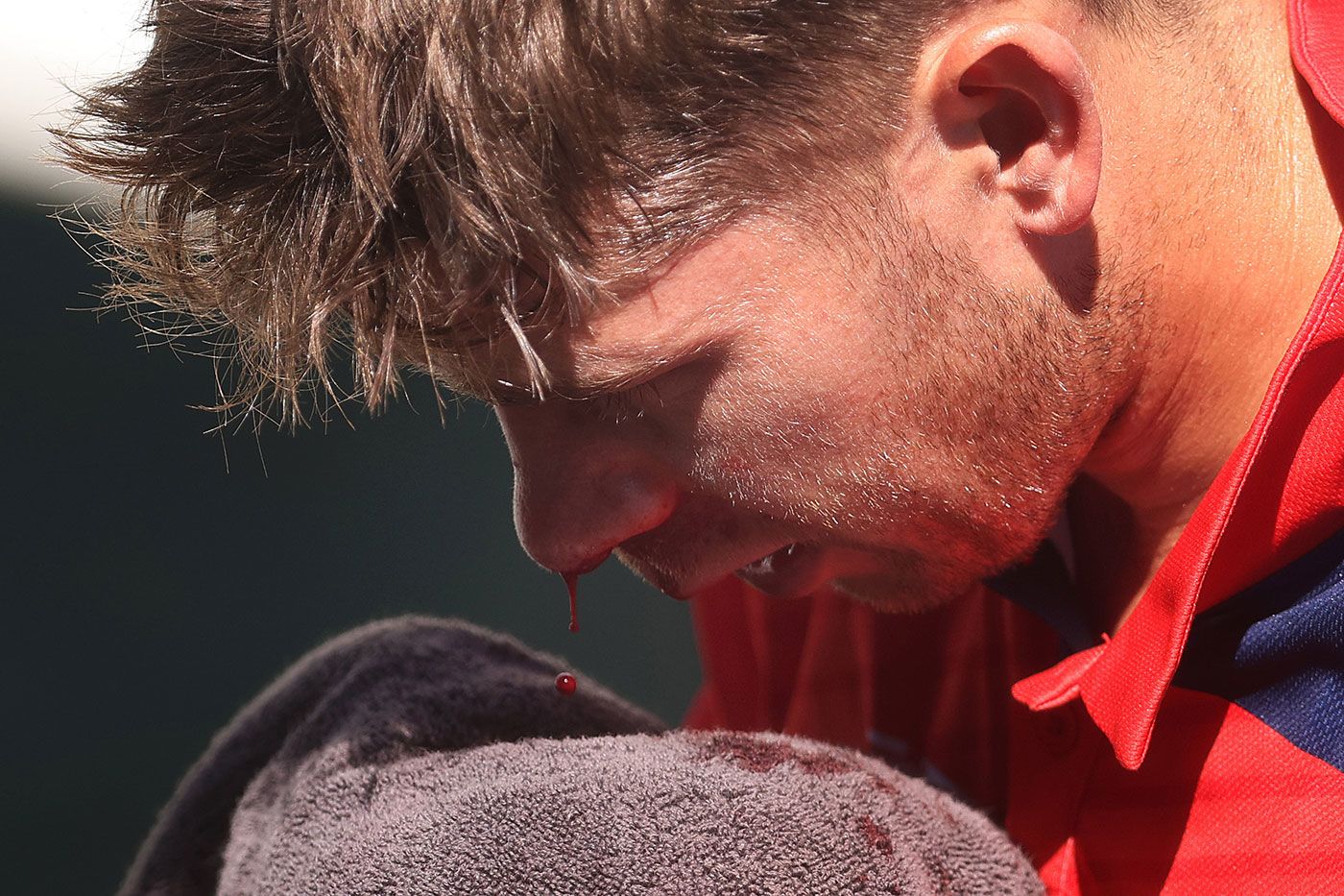 Henry Hunt suffered a nasty injury when he was struck in the face ...