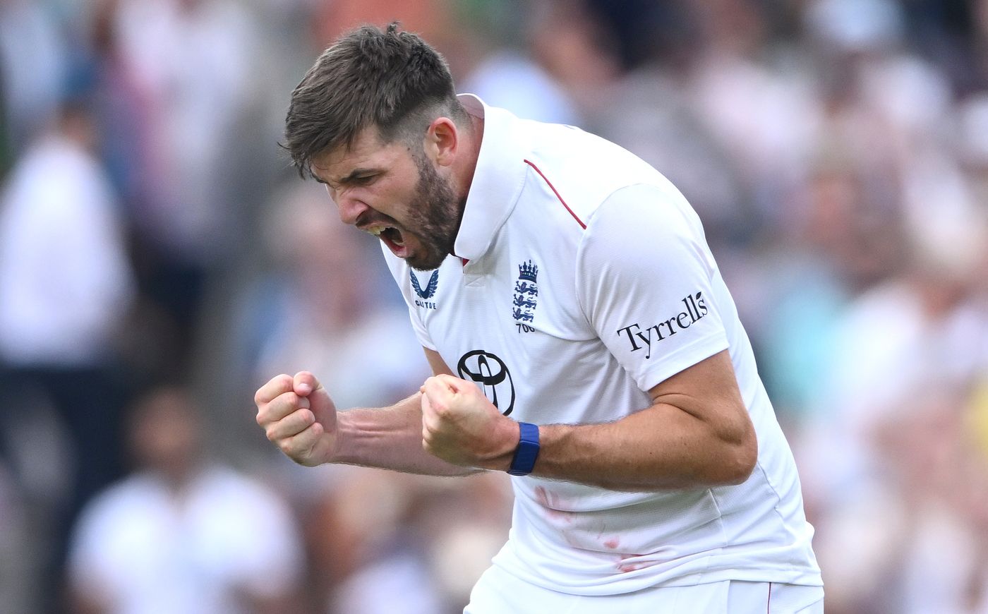 Jamie Overton celebrates Akash Deep's wicket | ESPNcricinfo.com